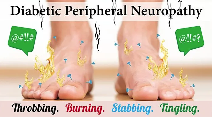 Peripheral Neuropathy - Neuropathy Treatment Methods